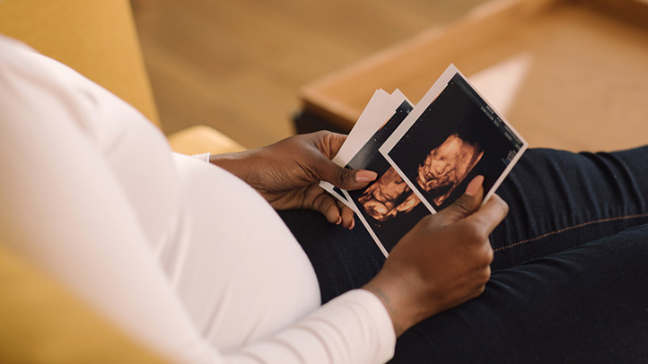 The Safety of 3D/4D 5D Ultrasounds What Parents Need To Know.